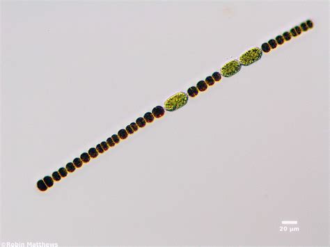 Cyanobacteria Nostocales Aphanizomenonaceae Dolichospermum Planctonicum Dolichospermum 575 