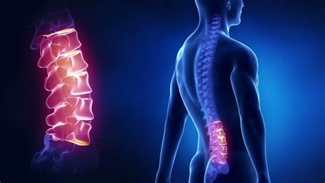 Github Ajiscokyphosis Prediction Using Random Forest Prediction Using Decision Tree