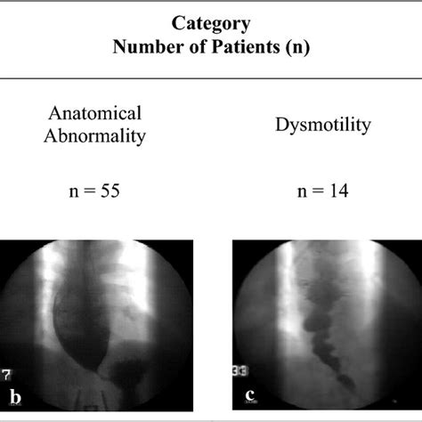 Improving The Diagnostic Capability Of The Modified Barium Swallow