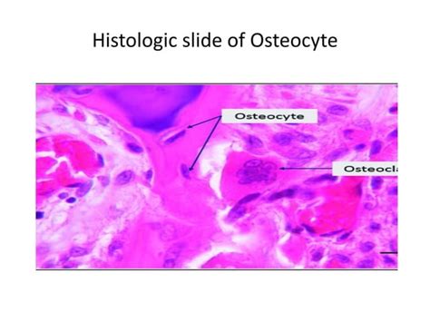 Bone Tissue Pptpptx Bone And Joint Conditions Diseases And Conditions