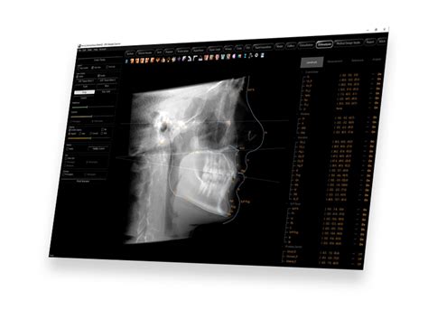 3d Analysis Osteoid Inc