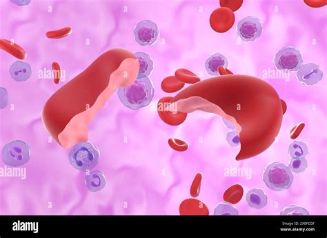 Hemolytic Anemia Ha Cells In The Blood Flow Closeup View 3d