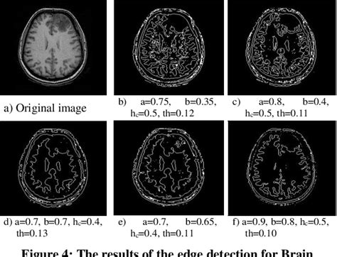 Figure 4 From Exponential Intuitionistic Fuzzy Entropy Measure Based Image Edge Detection