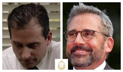 Steve Carell Hair Transplant I Secretly Think He Got A Hair