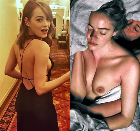 Emma Stone Sexy Nude Collage Photo Pinayflixx Mega Leaks