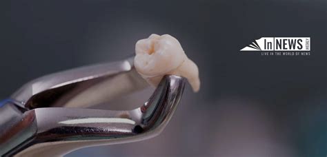 Solutions For A Missing Front Tooth In NewsWeekly