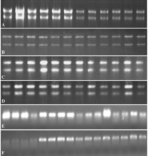 Total RNA Extracted By Methods Of RNA Isolation Kit A A Kit A B Download Scientific