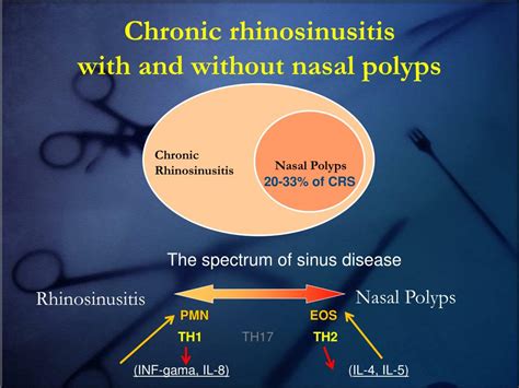 Ppt Nasal Polyps Pathogenesis And Treatment Implications Powerpoint Presentation Id4733914