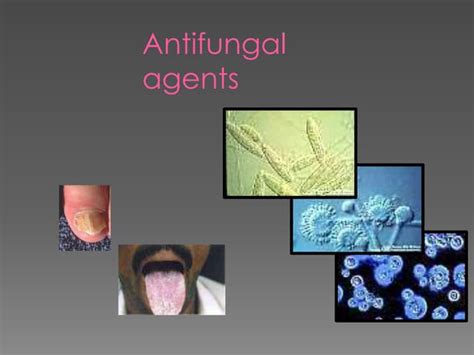 Anti Fungal Agent Pptx