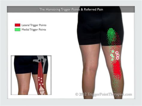 The Hamstring Trigger Points Hiding In Plain Sight The Hamstring Trigger Points Hiding In Plain Sight