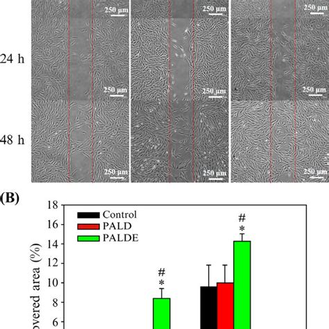 Schwann Cell Migration Assay A Migration Of Scs Among Different Download Scientific Diagram