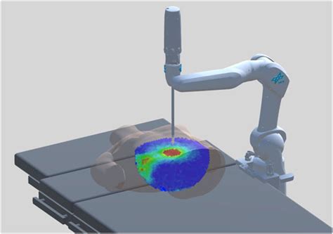 Frontiers Task Specific Robot Base Pose Optimization For Robot Assisted Surgeries
