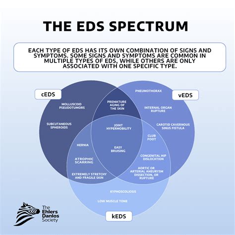 Eds Spectrum Graphic