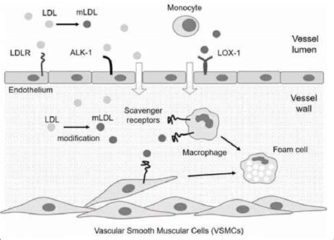 Simplified Scheme Of Foam Cells Formation In The Subendothelial Space