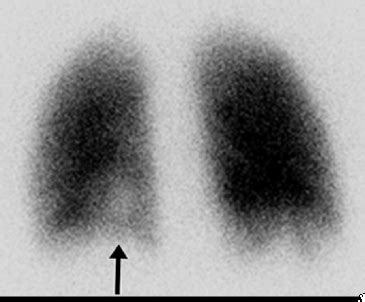 VQ Scans Flashcards Quizlet