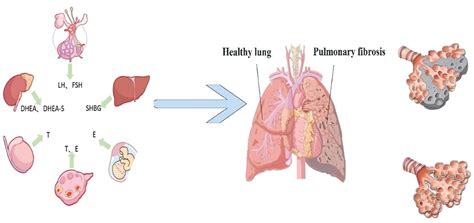 Meta Analysis Of The Association Between Sex Hormones And Pulmonary