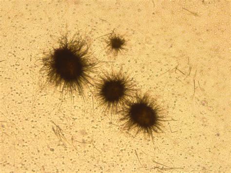 Molds In A Microscope Rmoldlyinteresting