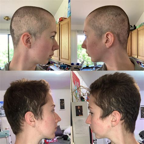 update photo i m not 100 pull free and don t know if i ll ever be