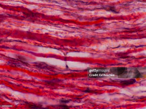 Node Of Ranviermyelinated Nerve Fiber In A Nerve Longitudinal Section