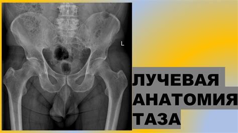 Лучевая анатомия таза Как выглядит таз на рентгенограмме Youtube