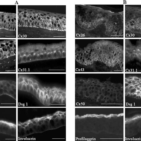 Overlapping Yet Distinct Expression Patterns Of Cx26 30 31 1 And Download Scientific