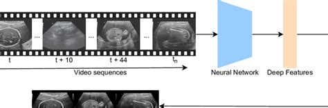Overview Of The Standard Plane Detection Algorithm As Input We Use A Download Scientific