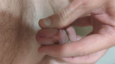 Meatotomy Fingering And Cum