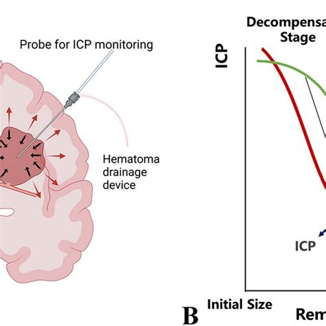Icp Monitoring In The Management Of Intracerebral Hemorrhage Download Scientific Diagram