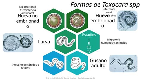 Toxocariasis Ocular Larva Migrans Toxocara Canis Y Cati Helmintos
