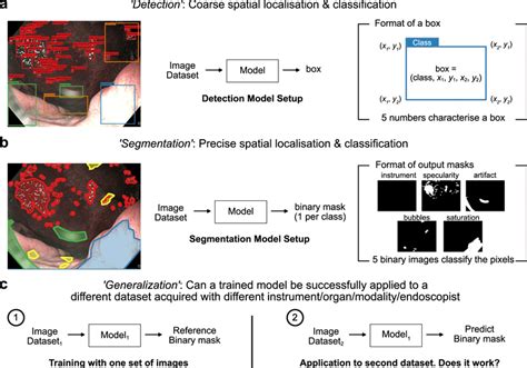 The Three Sub Challenges Of The Endoscopy Artefact Detection Ead Download Scientific Diagram