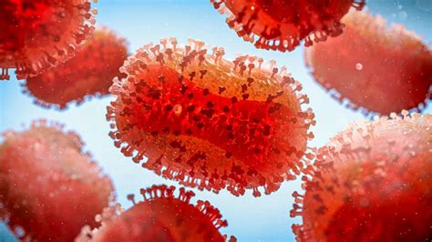 Ирландад сармагчны цэцэг өвчин туссан анхны хүн бүртгэгдлээ