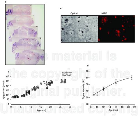 Near Infrared Fluorescence Nirf Imaging Of An App23 Mice Model Of