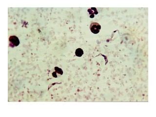 Trypanosomiasis Sleeping Sickness Disease Of Africa Pdf