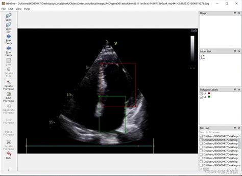 【目标检测】swin Transformer训练自己的数据集 Swin Transformer训练自己的数据 Csdn博客