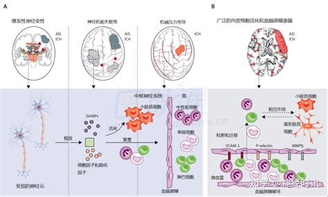 戚晓昆教授：缺血性卒中神经组织炎症损伤机制与治疗探索 知乎