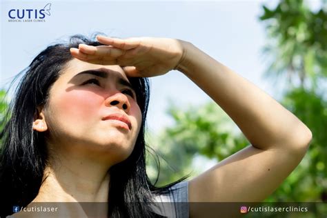 When Do You Start To See Sun Damage