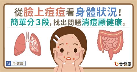 下巴長痘＝生殖系統gg！從「冒痘痘3位置」看身體哪生病了 Ettoday健康雲 Ettoday新聞雲