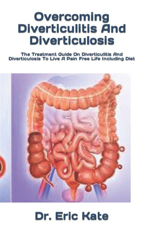 Overcoming Diverticulitis And Diverticulosis The Treatment Guide On Diverticulitis