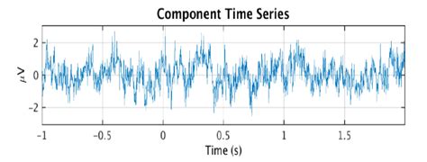automatic eeg artifact removal using blind source separation meth