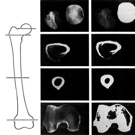 The Quantitative Computer Tomography Measurements Were Performed At The