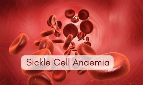 Govt Slashes Sickle Cell Test Kit Price Below Rs 50