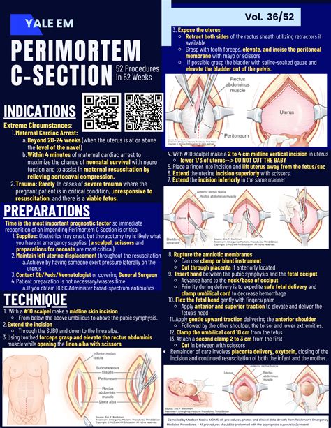 Procedure Of The Week — Yale Emergency Medicine