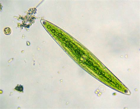 Oo28oo Requested Some Eukaryotic Algae Pictures