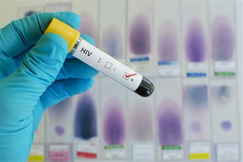Cómo Funciona Un Nuevo Revolucionario Tratamiento Aprobado Por La Fda