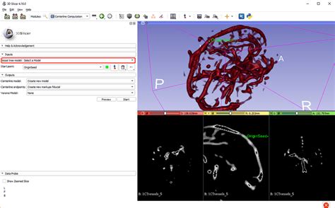 Vmtk Centerline Computation Problem Support 3d Slicer Community
