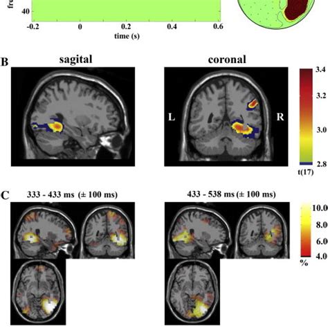 Permutation Statistics In Sensor And Source Space Time Frequency Plot Download Scientific