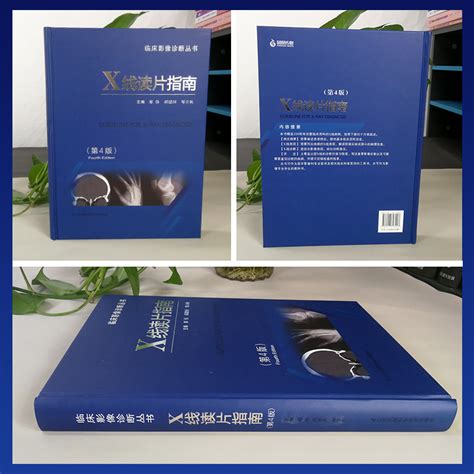 正版 X线读片指南第4版第四版医学检查鉴别放射诊断学系列图谱邢伟邱建国精装实用临床影像诊断报告丛书籍x光江苏凤凰科技出版社虎窝淘