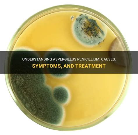 Understanding Aspergillus Penicillium Causes Symptoms And Treatment