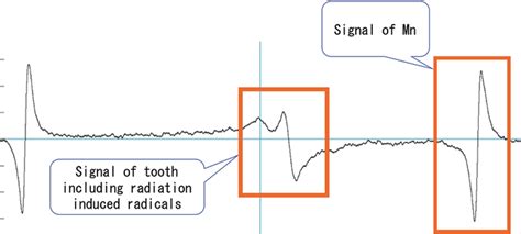8 Example Of Spectrum Obtained By X Band Esr Tooth Dosimetry In The Download Scientific