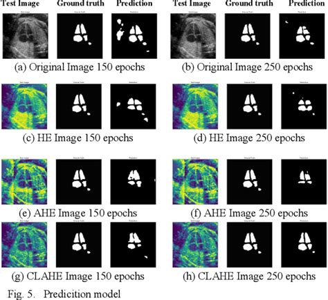 Figure 5 From Histogram Equalization Methodologies Comparison For Deep Learning Model In Fetal